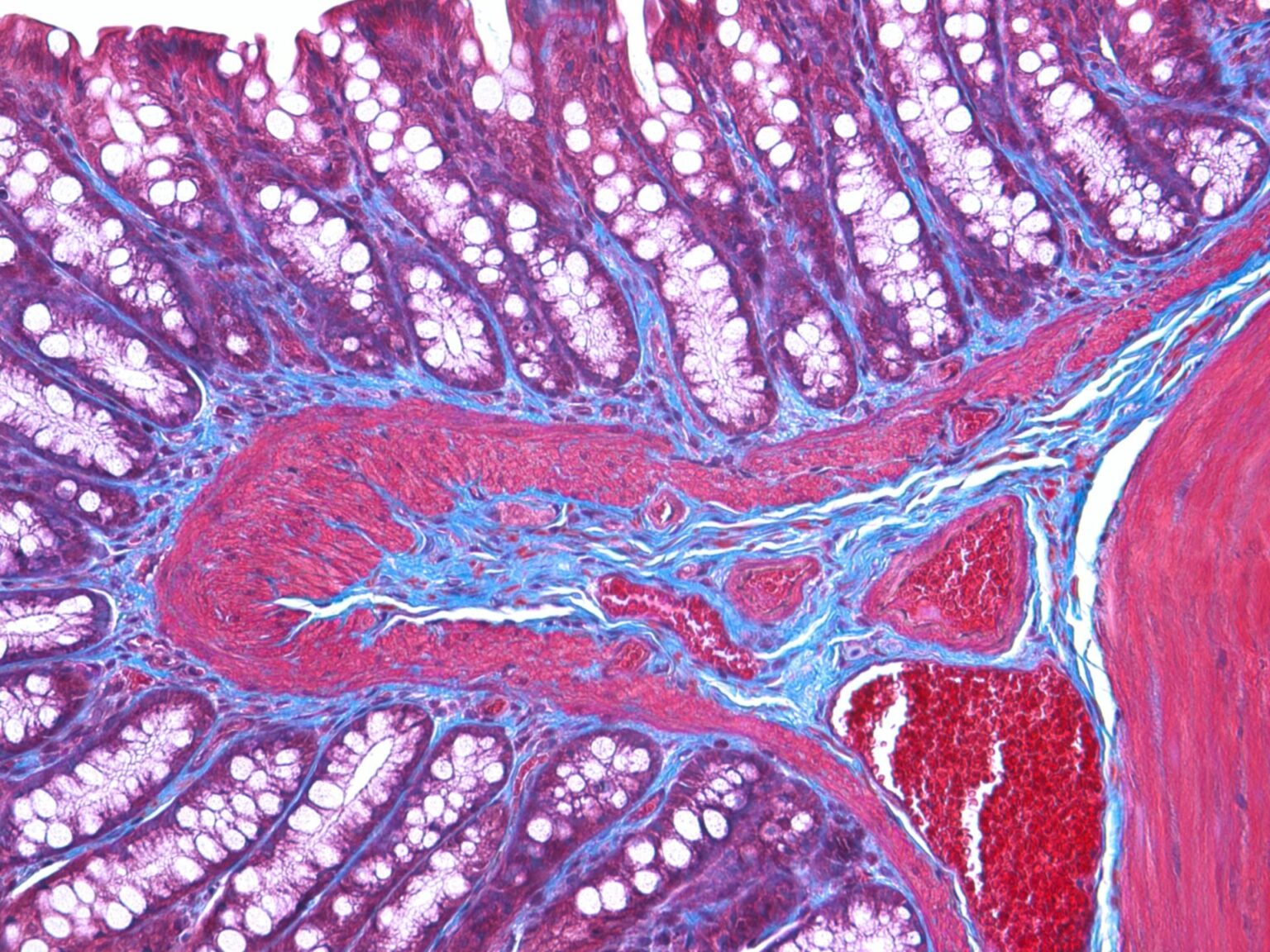 Free Pathology Board Exam Sample Questions - BoardVitals Blog