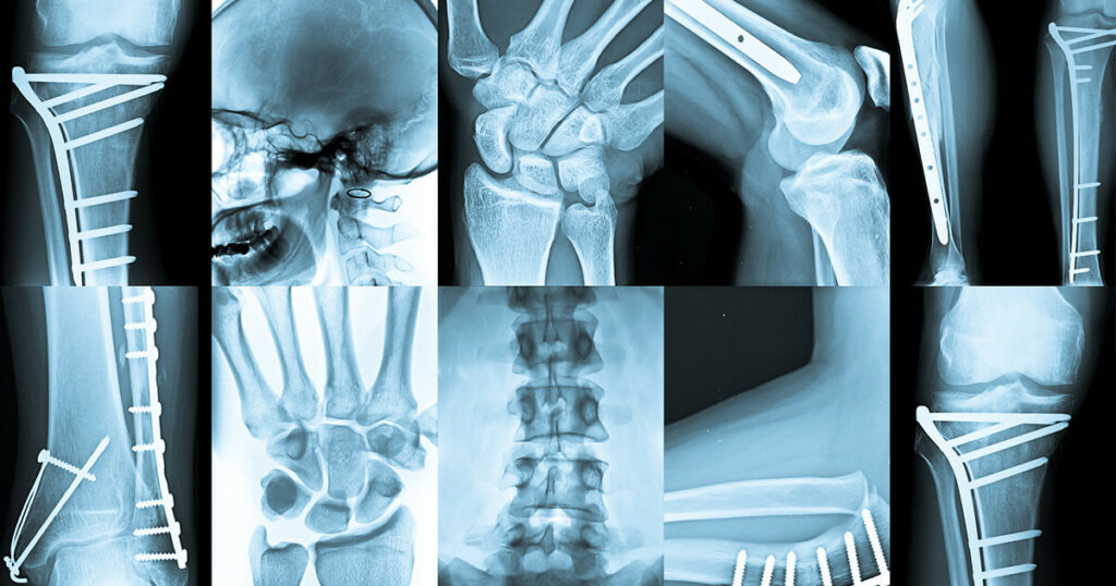 FAQs about the ARRT® Radiography Exam - BoardVitals Blog