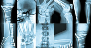FAQs about the ARRT® Radiography Exam - BoardVitals Blog